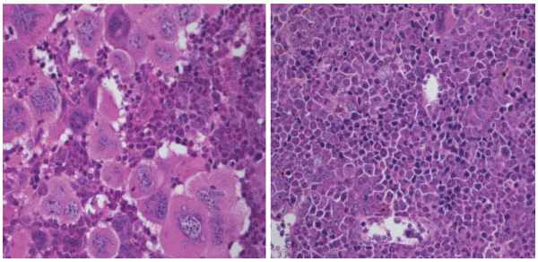 My Northwestern Medicine for November 18, 2015