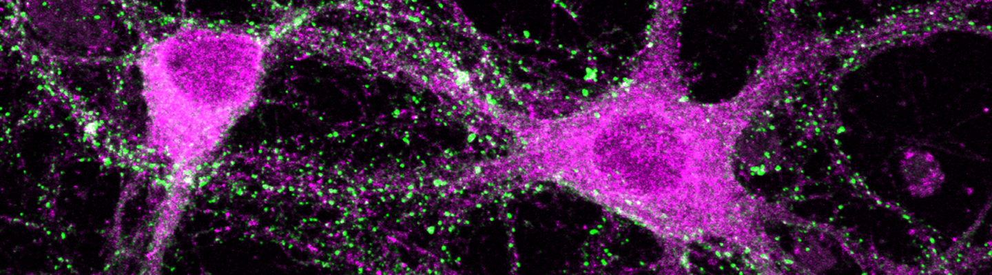 Home: Center for Autism and Neurodevelopment: Feinberg School of Medicine