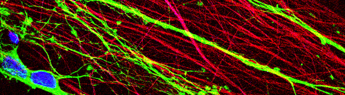 Center for Advanced Microscopy & Nikon Imaging Center : Center for ...